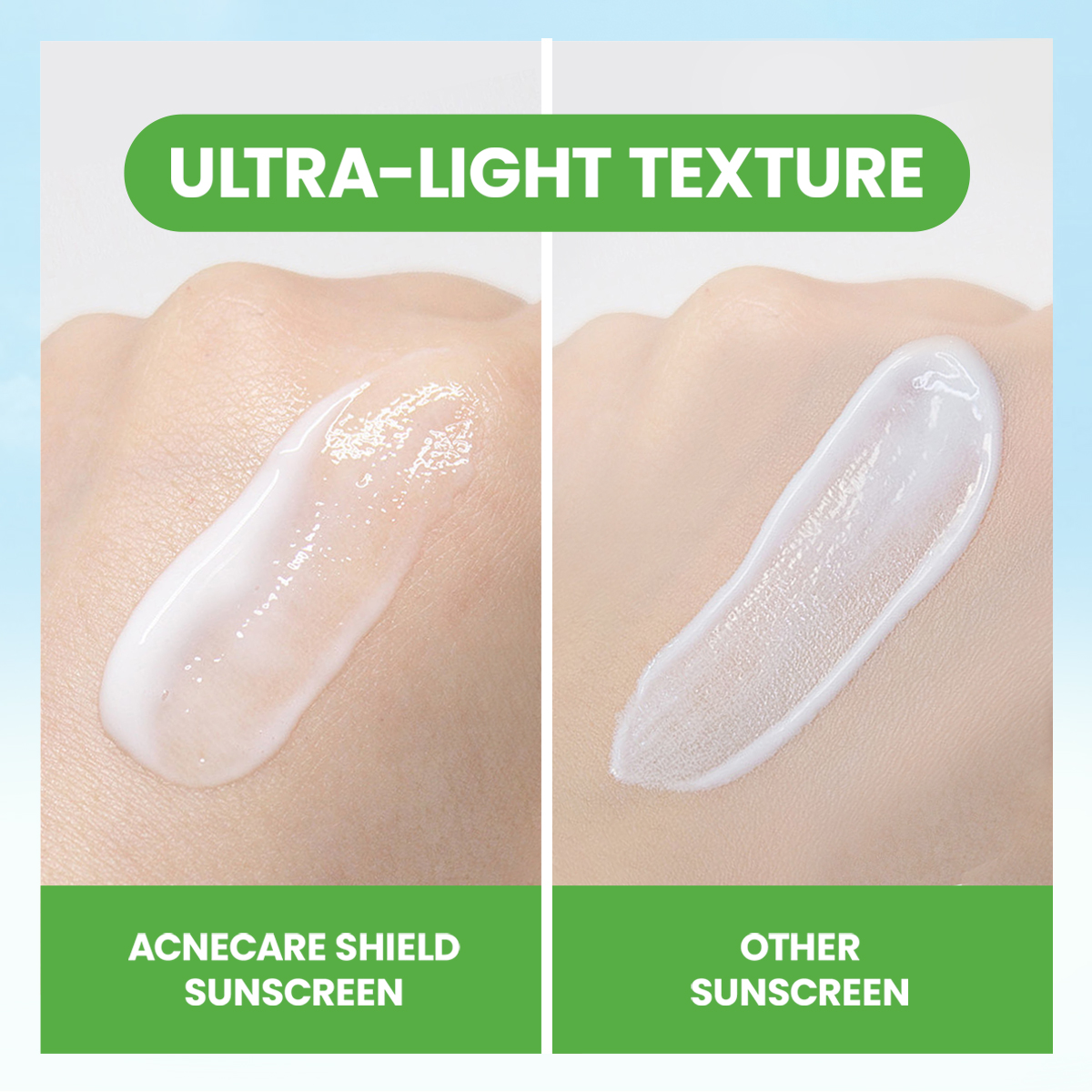 Jual YOU Sunbrella Pro Acnecare Shield Sunscreen SPF 50+ PA++++ Acne ...