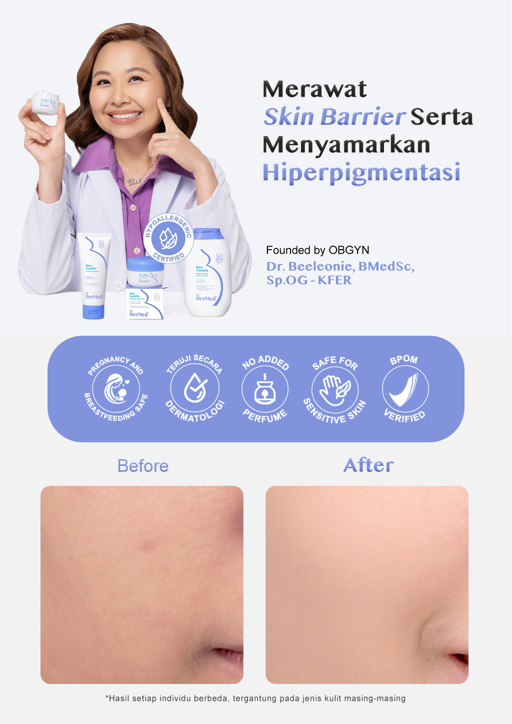 Jual Dr.BeeMed Bee Gentle Balancing Moisturizer 20g - Pelembap Kulit ...