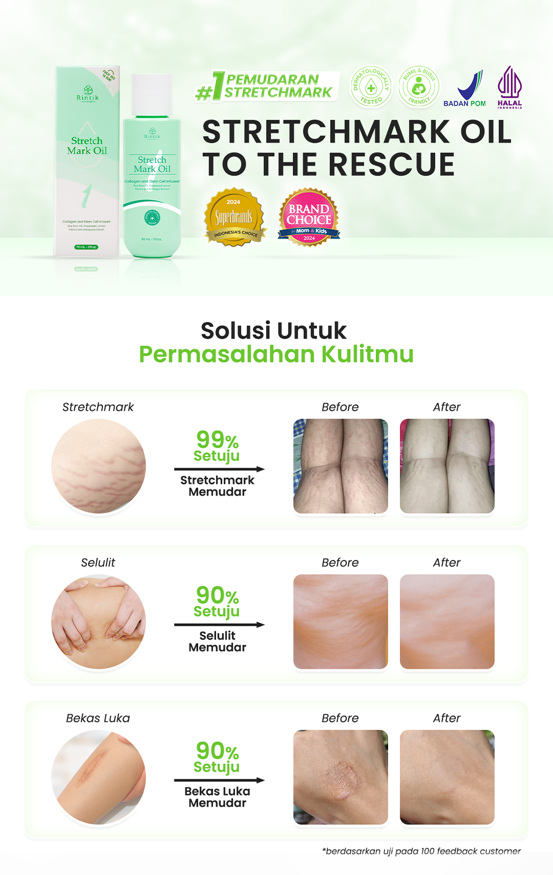 Jual Rintik Skincare Stretchmark Oil - Terbukti Ampuh Memudarkan ...