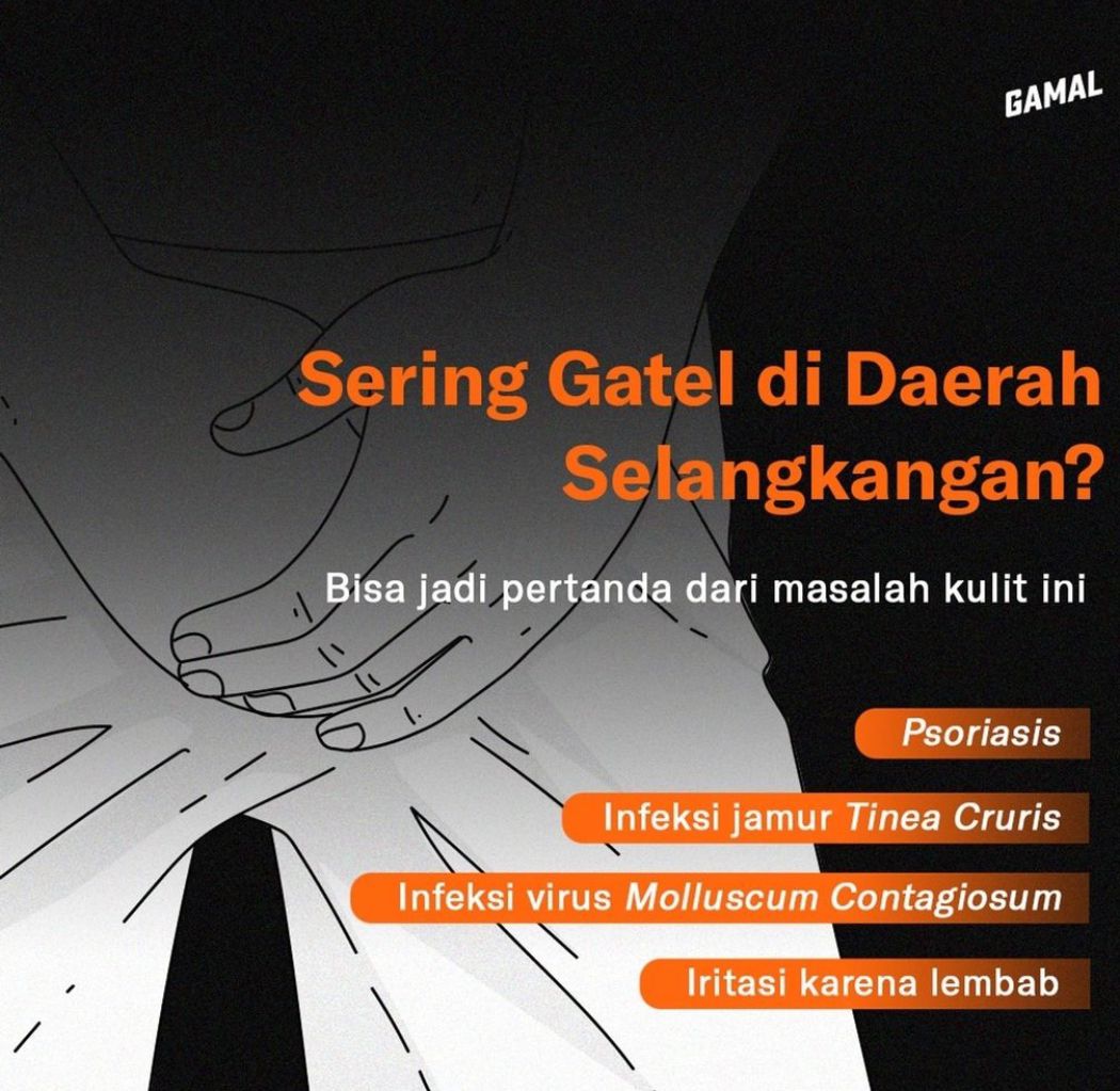 Jual GAMAL | Joni Cream | 30ml | Dermatology Tested | Krim Perawatan ...