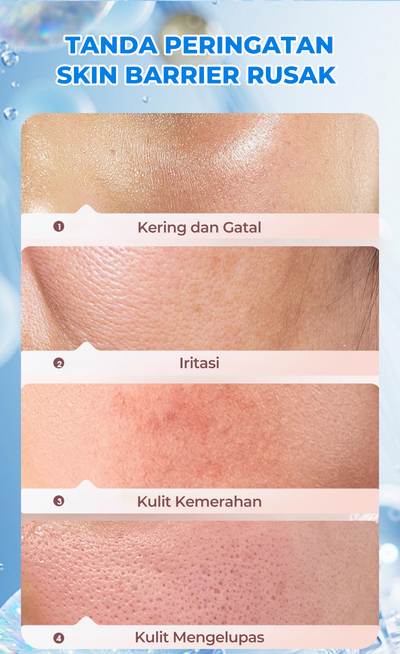 Jual OHSOME - The Originote Hyalucera Moisturizer Gel Pelembab Wajah ...