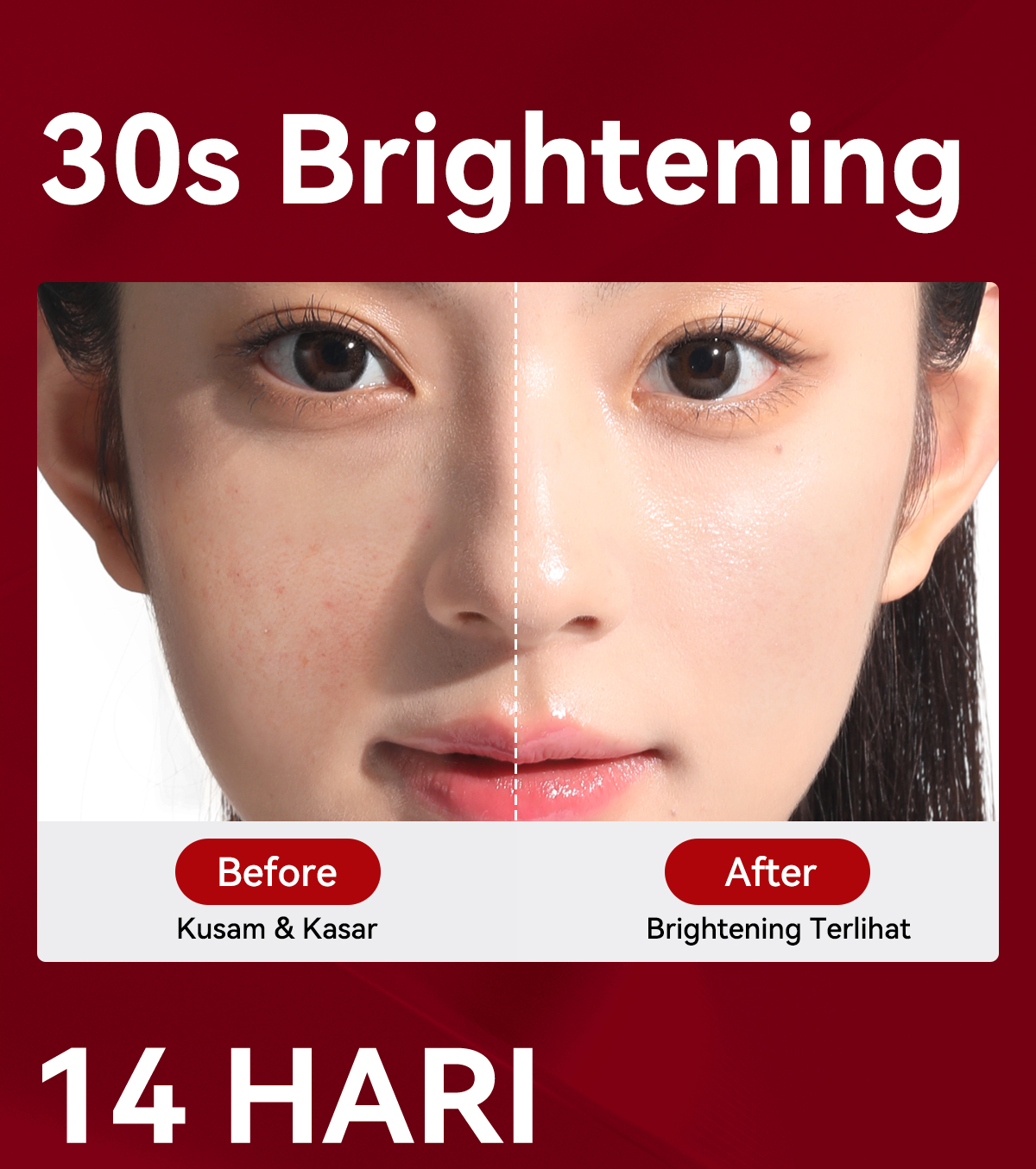 Jual FOCALSKIN Peeling Solution Serum 30ml - 20% Acid Intensive ...