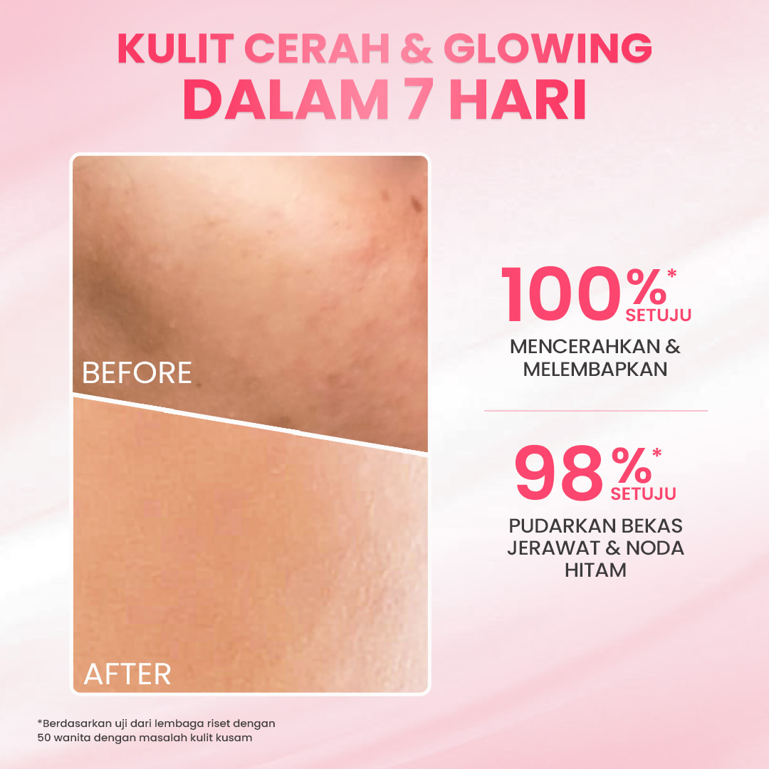 Jual Hanasui Glow Expert Toner Essence New Improved Formula - Hidrasi ...