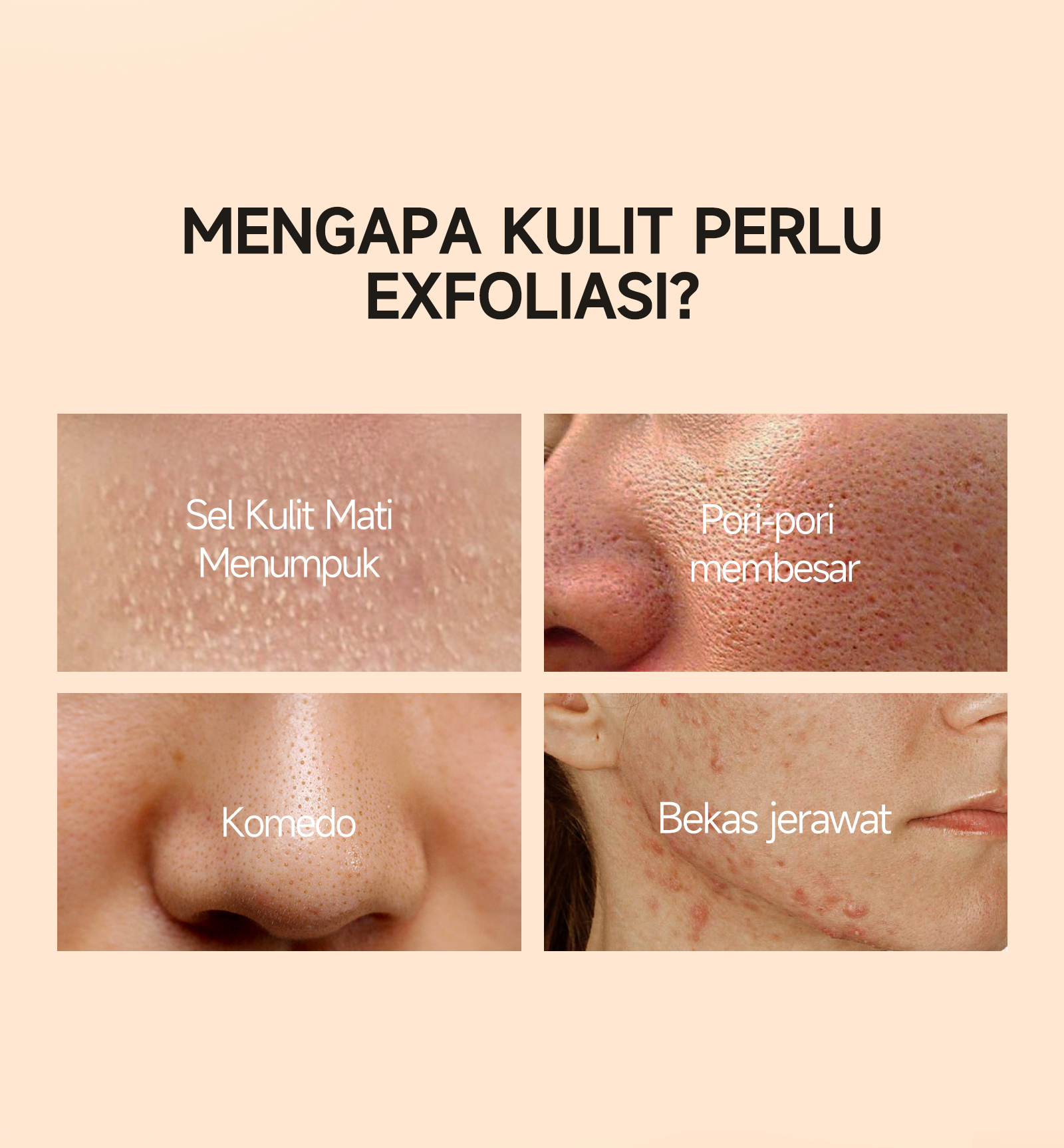 Jual GMEELAN 2PCS Orange Exfoliating Gel 50g Pengelupasan Kulit Peeling ...