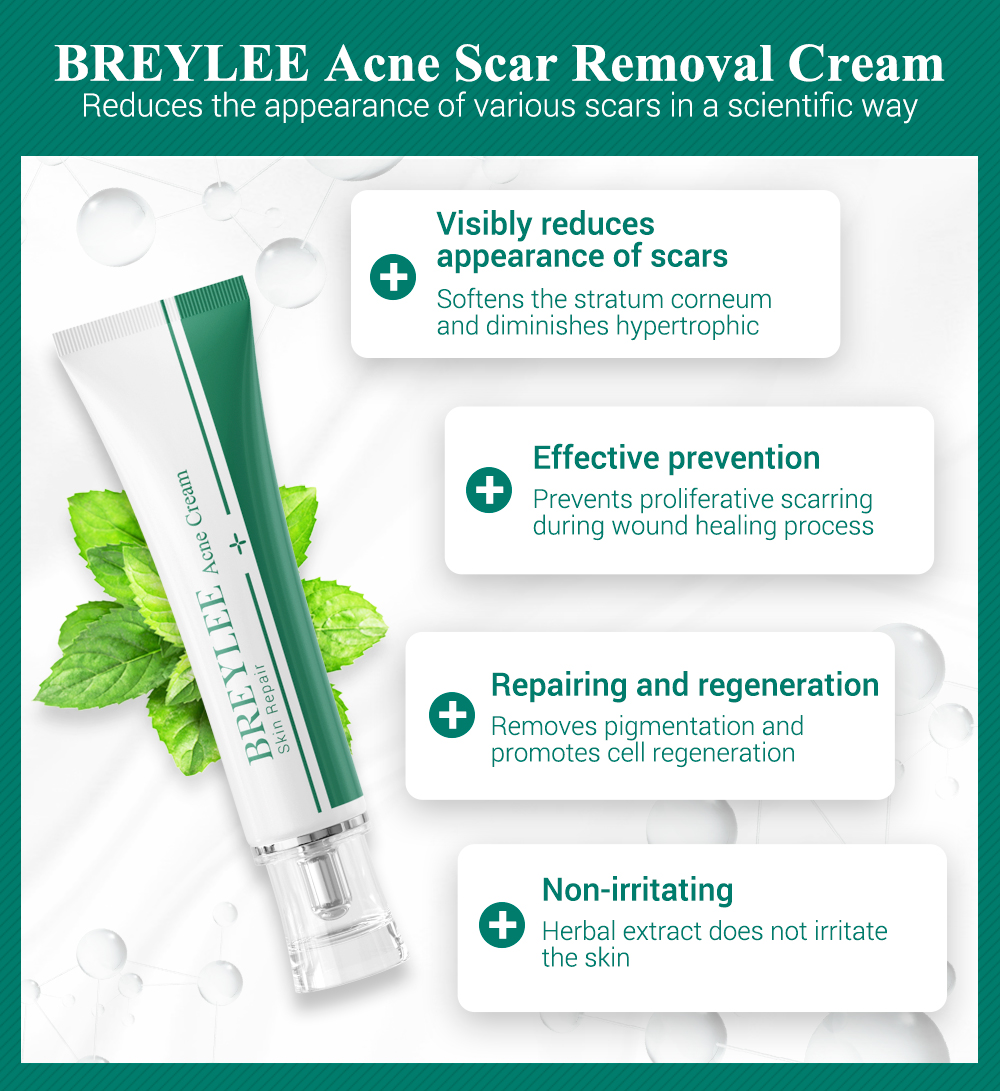 Jual 【BPOM】BREYLEE Acne Scar Removal - BREYLEE Penghilang Noda Bekas Jerawat, Luka & Stretch ...