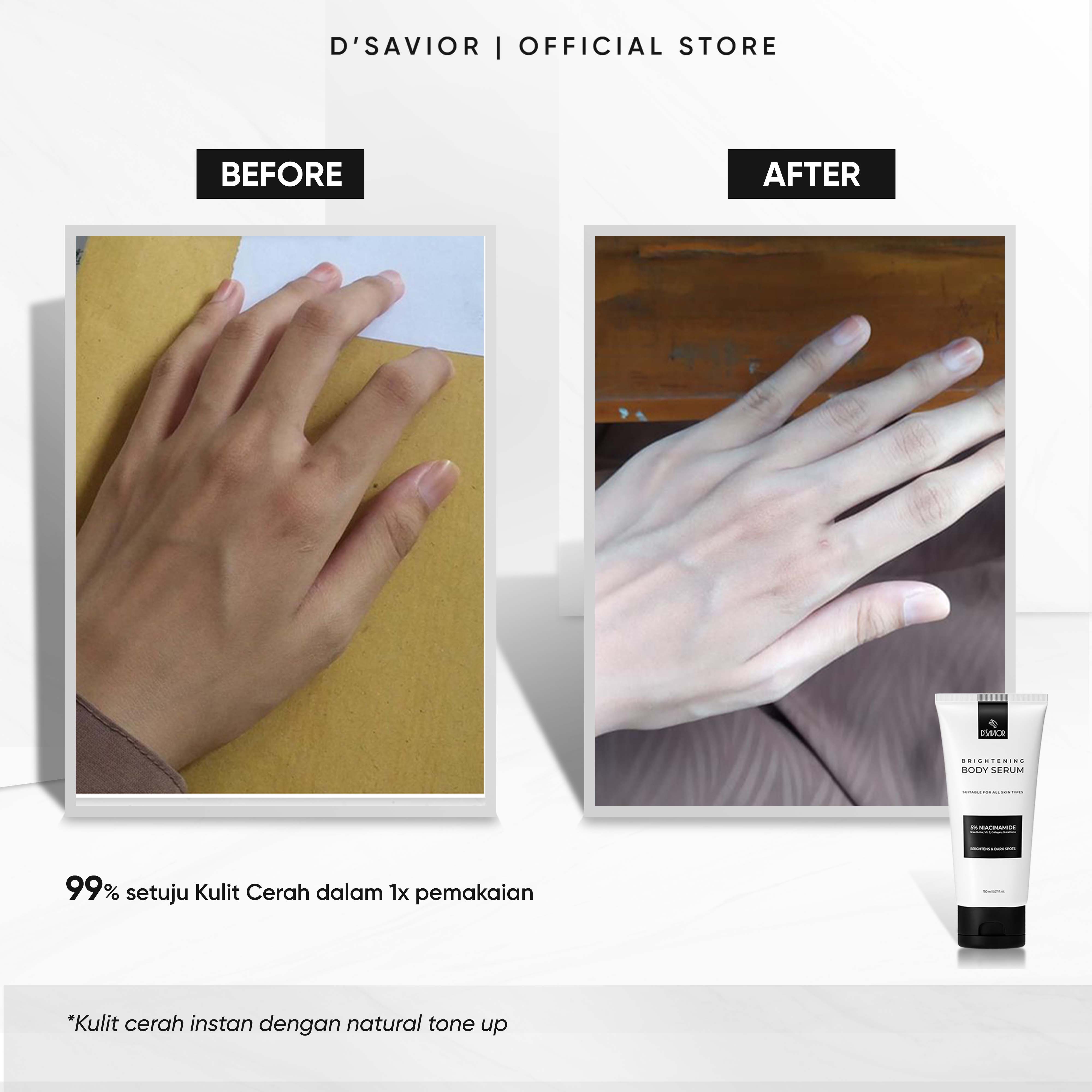 Jual D'SAVIOR Bundling Isi 2 Brightening Body Serum Bilancia dan ...