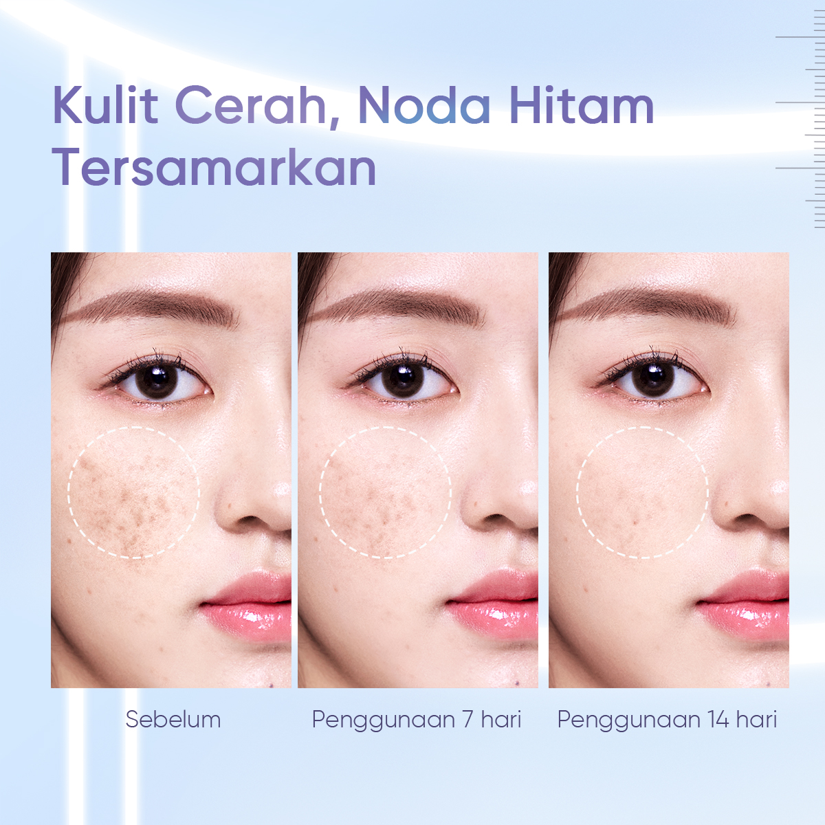 Jual SKINTIFIC - 377 Pro Dark Spot Essence Toner 80ml | Flek Hitam ...