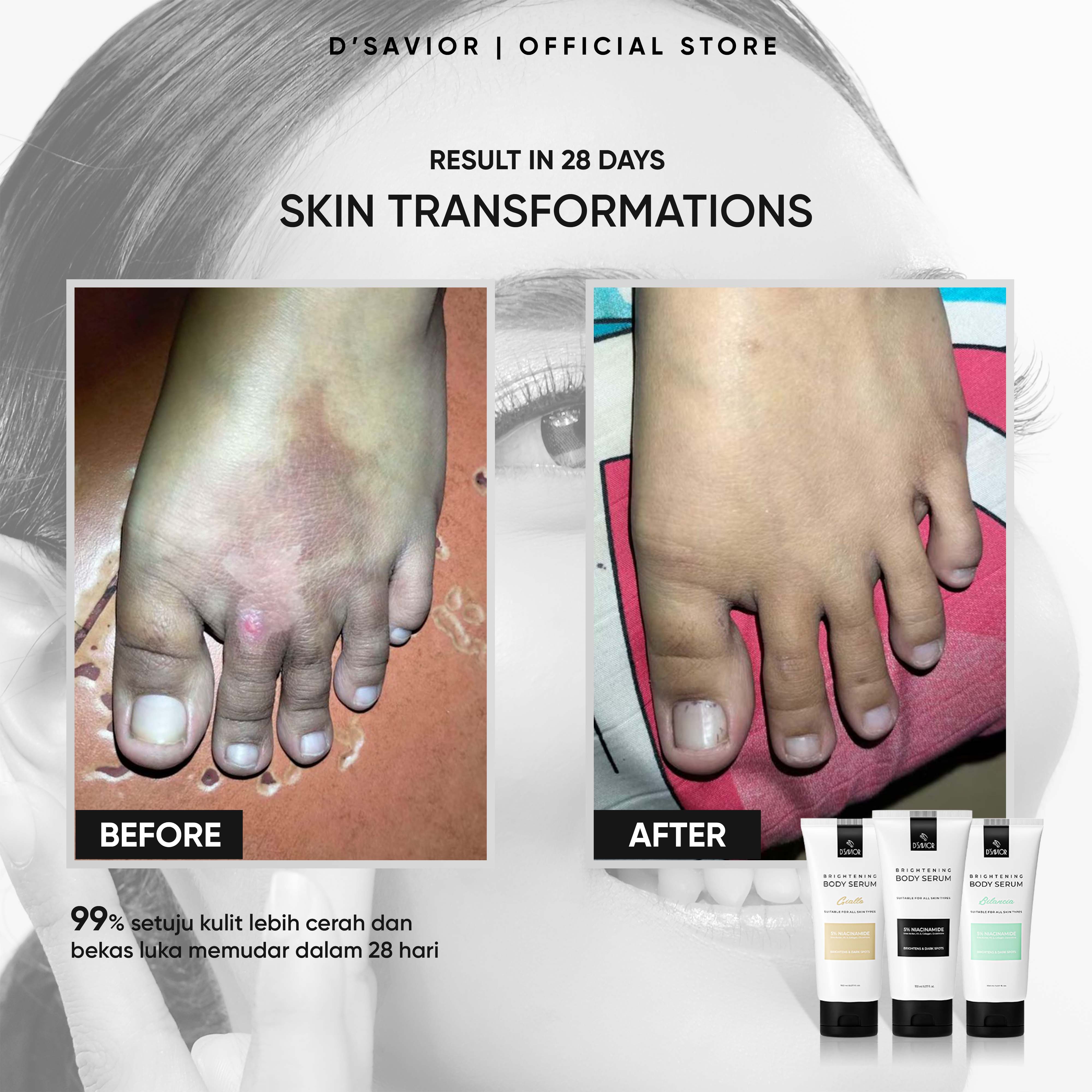 Jual D'SAVIOR Body Serum Brightening Niacinamide 5% | Travel Size 50ml ...