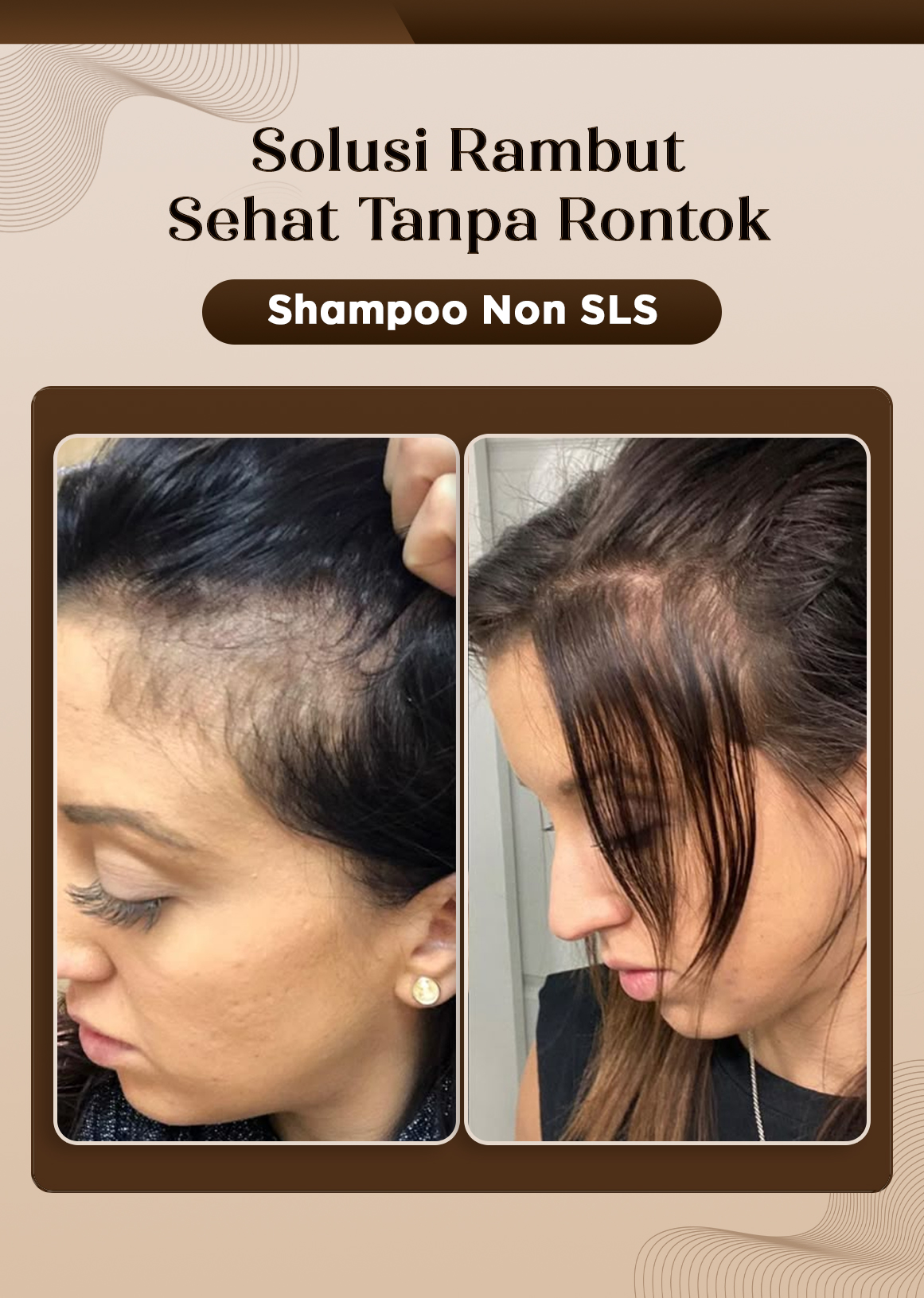 Jual Jevarine Mild Shampo All in One - Shampo Non SLS Membantu ...