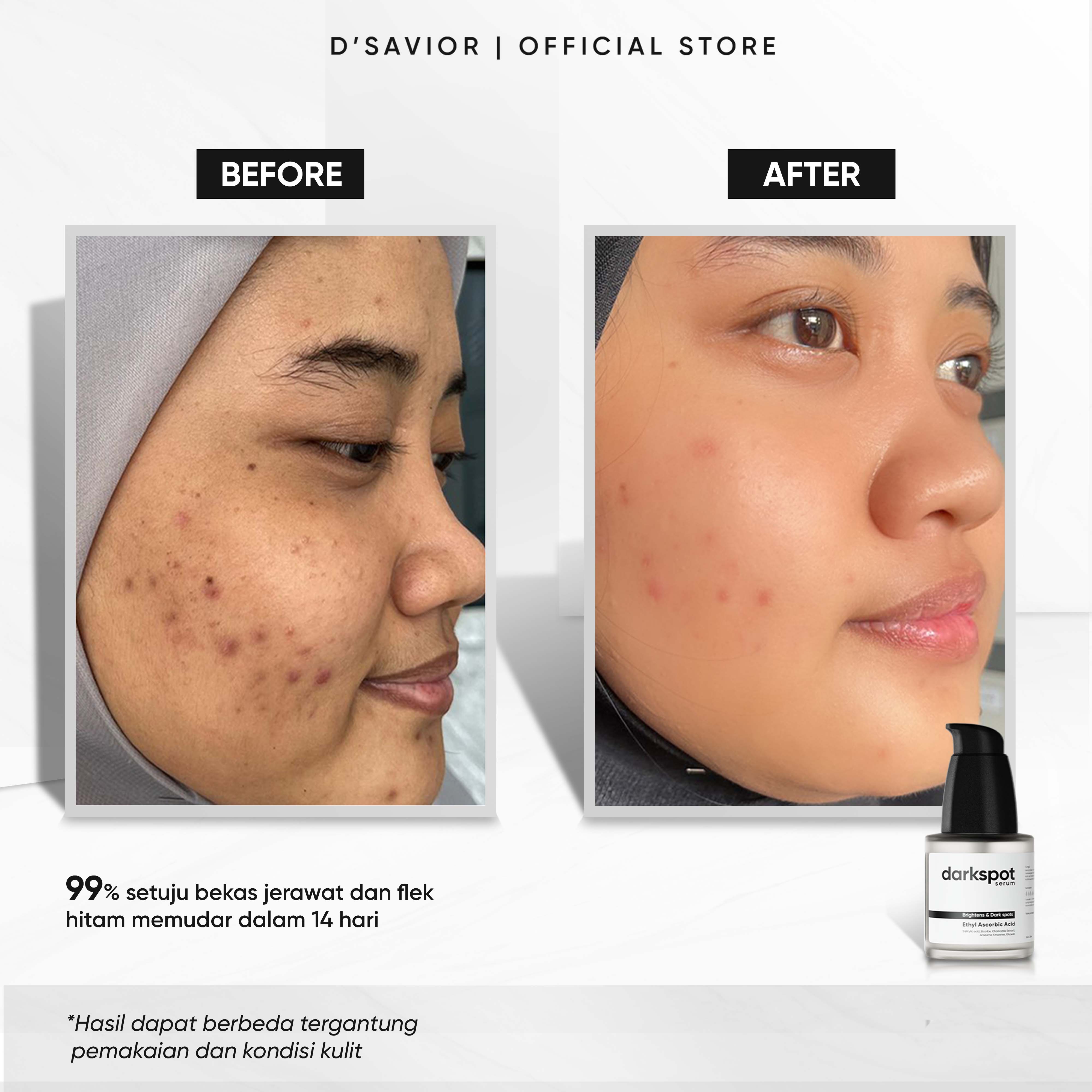 Jual D'SAVIOR Darkspot Serum Ethyl Ascorbic Acid 20ml | Serum Wajah ...