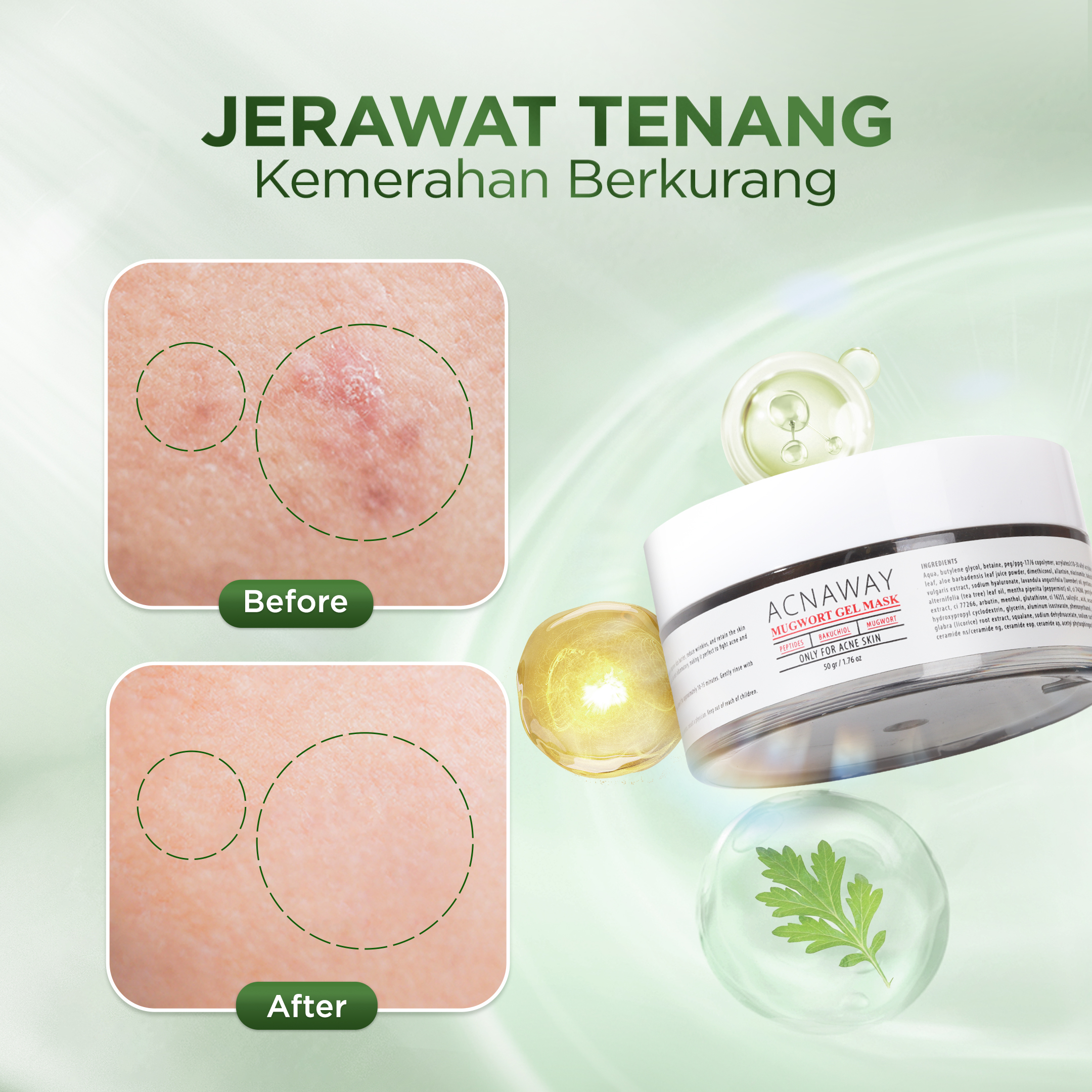 Jual ACNAWAY 2PCS Advanced Mugwort Gel Mask – Face Mask Gel Masker ...