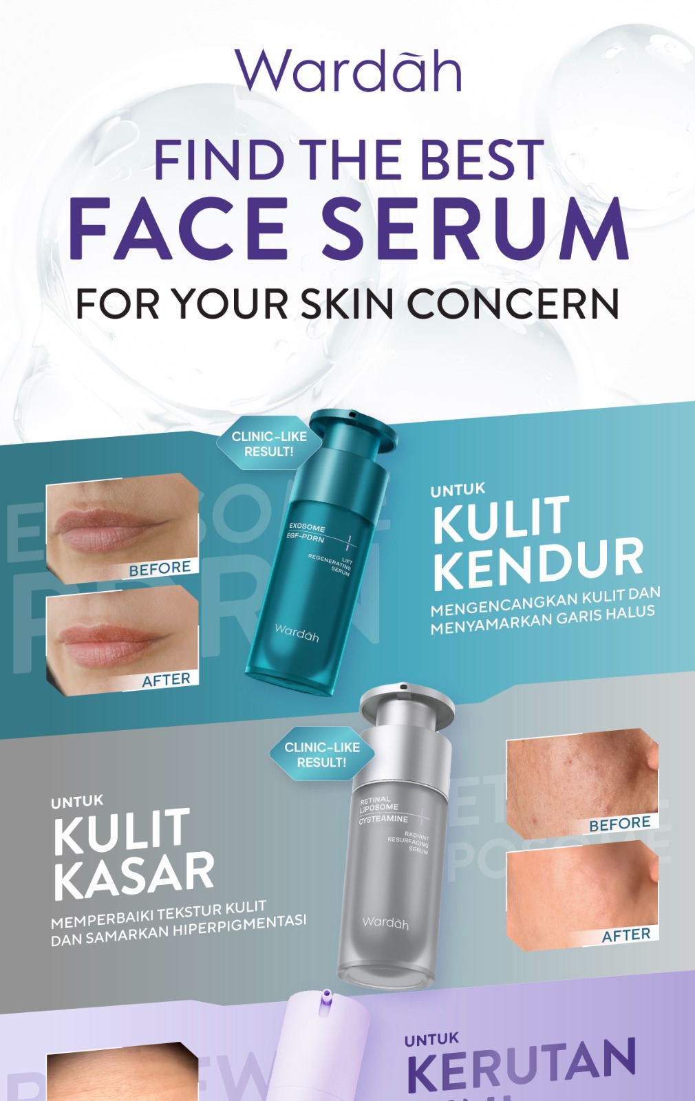 Jual WARDAH Serum Complete Series For Every Skin Concern - Microneedle ...