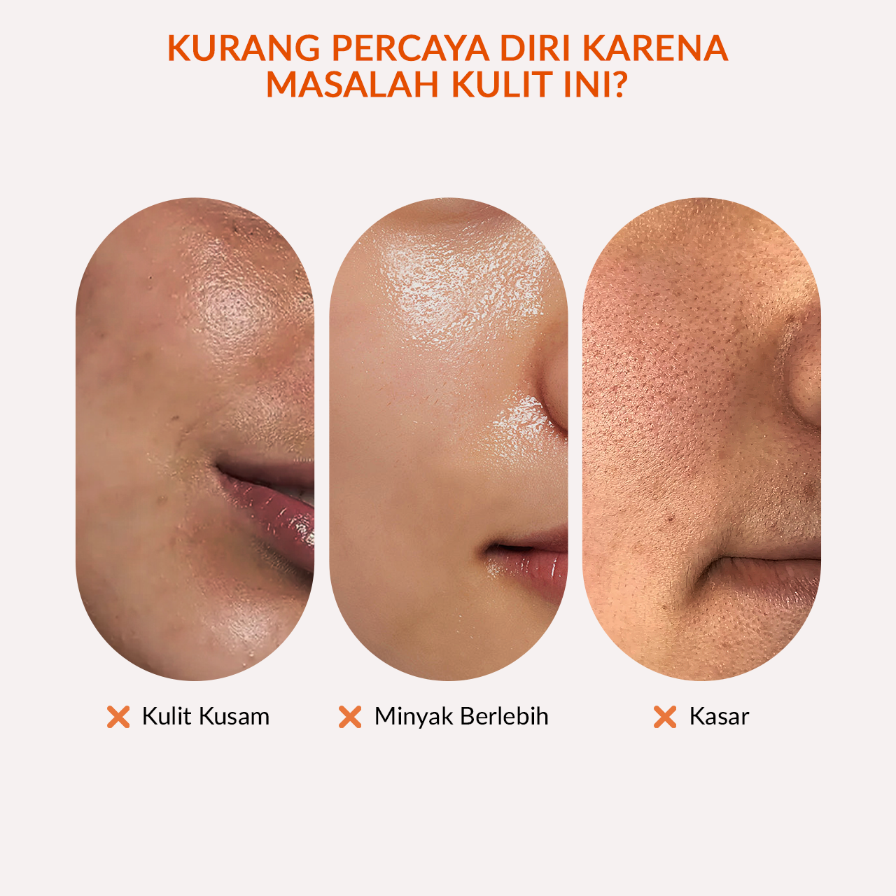 Jual [NEW LAUNCH]-BIOAQUA Skincare Paket Fresh Lemon Bright Set Skincare Paket With Facial Wash ...