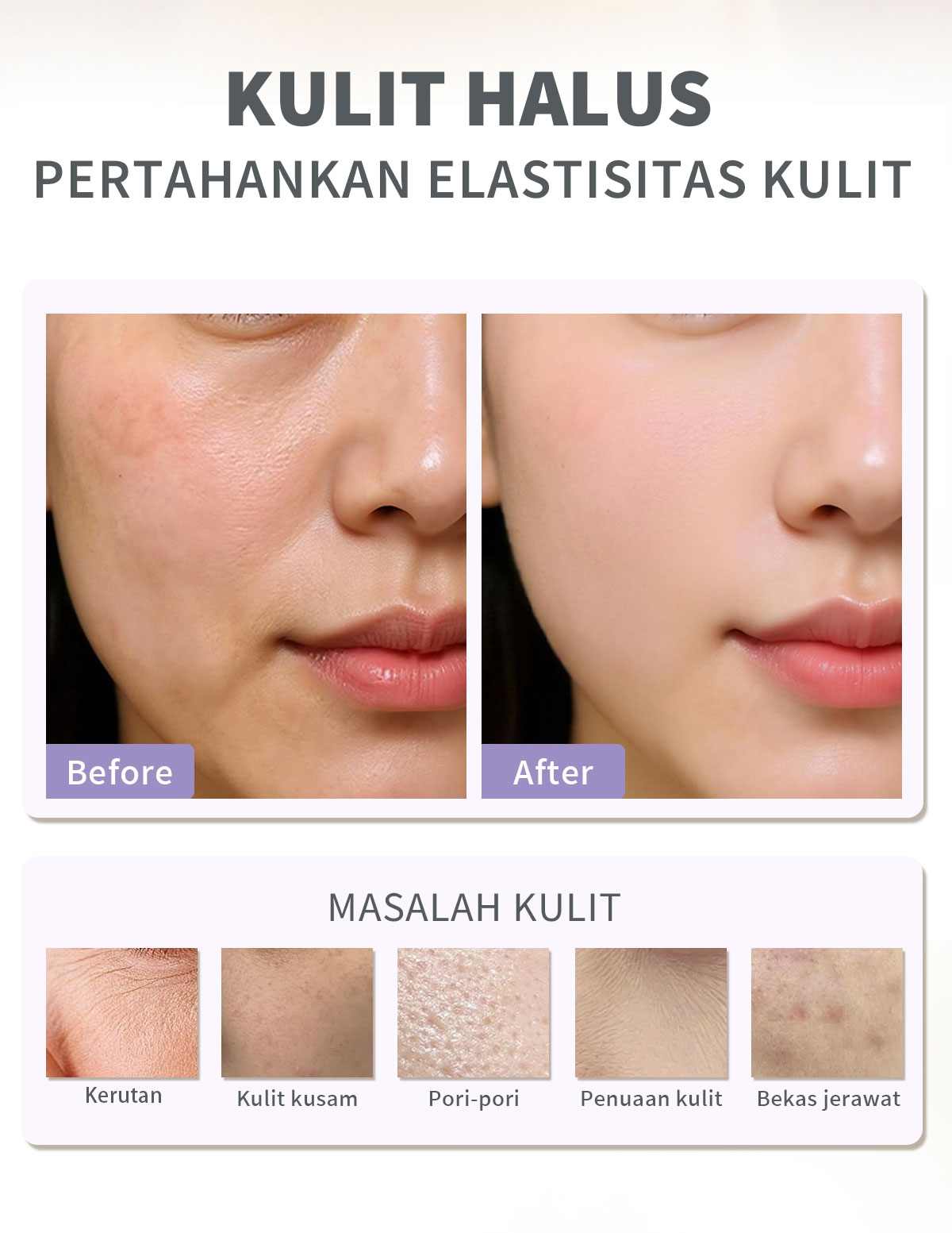 Jual [NEW LAUNCH]ONLYOU 2% Reti-Peptide Spring Back Serum - Retinol ...