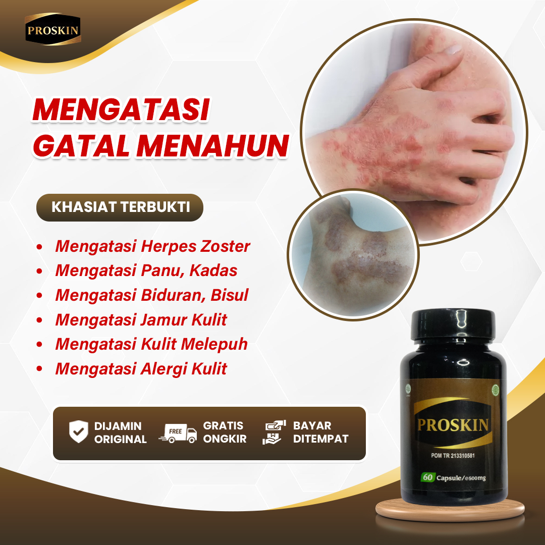 Jual Proskin Asli 100% Original Obat Herbal Mengatasi Biduran Pada ...