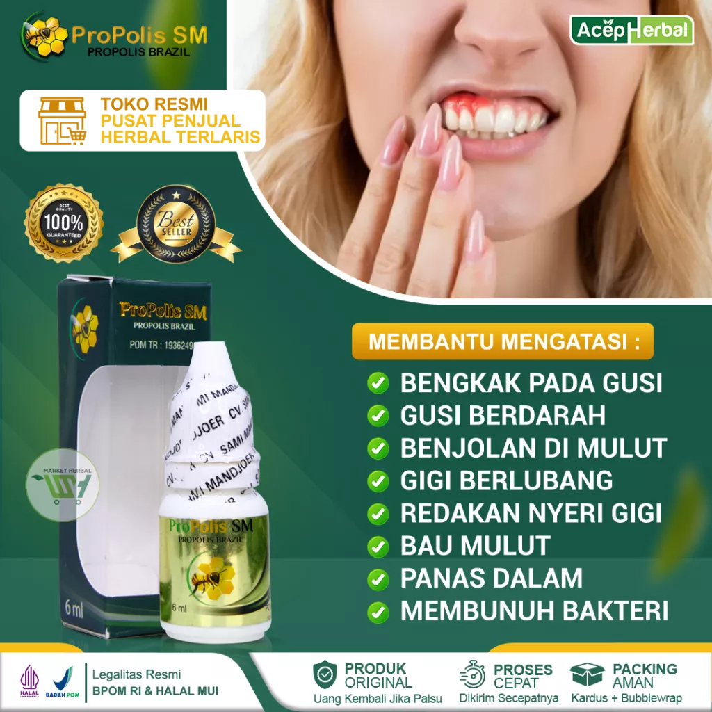 Jual Obat Gusi Bengkak Gusi Berdarah Gigi Berlubang Abses Gigi Gusi ...