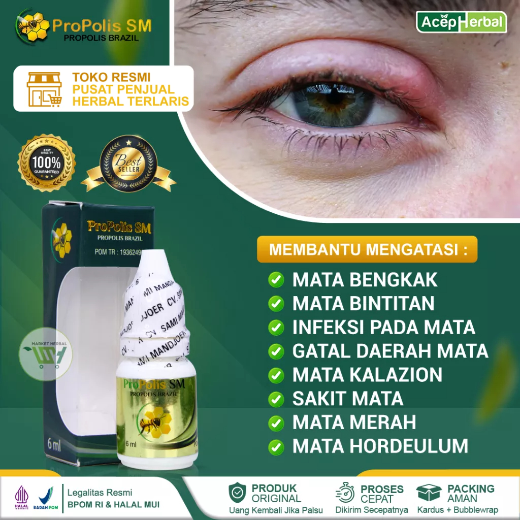 Jual Obat Mata Bintitan Obat Penghilang Mata Bintilan Luar Dalam ...