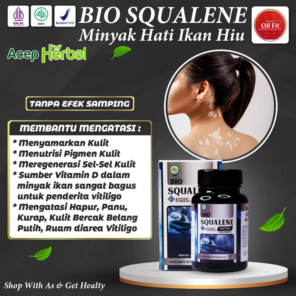 Jual Obat Vitiligo Kulit Bercak Belang Putih Panu Hapur Kurap Jamur ...