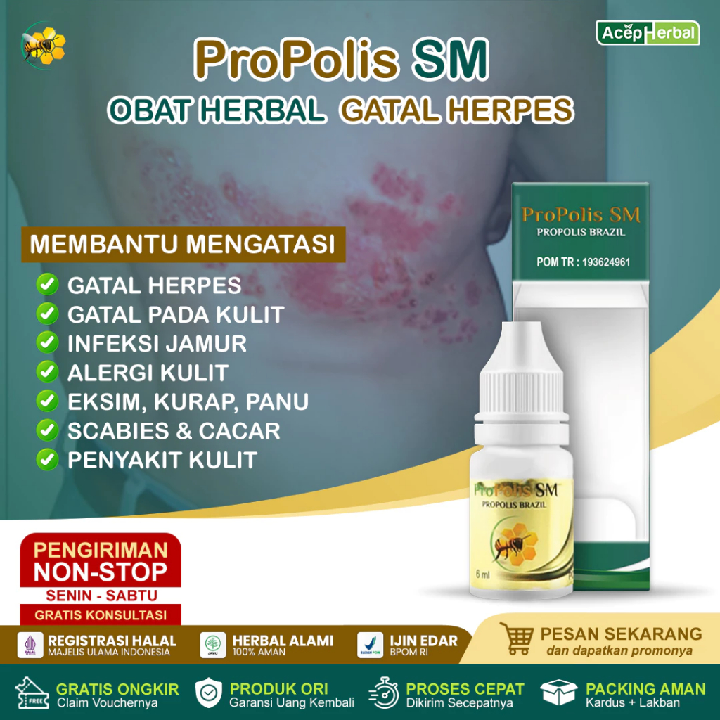 Jual Propolis SM Brazilian 100% Asli Untuk Gatal Herpes Kulit Kencing ...