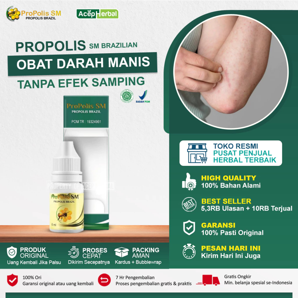 Jual Obat Darah Manis Obat Ruam Prurigo Obat Amis Daging Obat Biduran ...