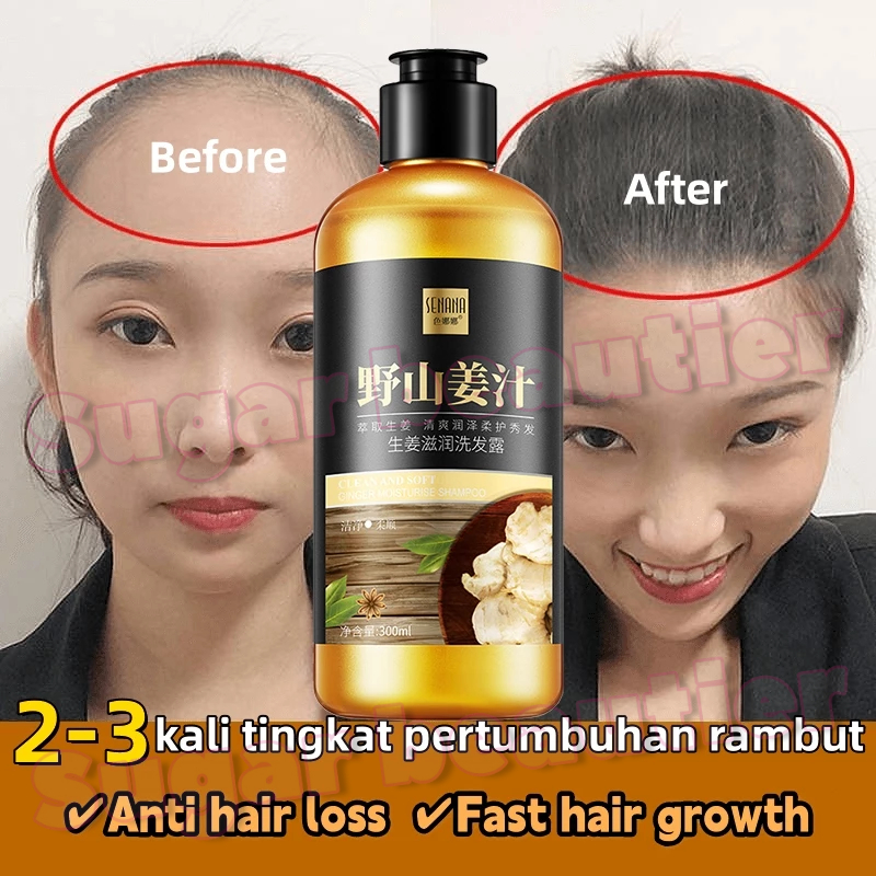 Jual Shampo Penumbuh Rambut Cepat Ginger Shampoo 300ml pertumbuhan ...