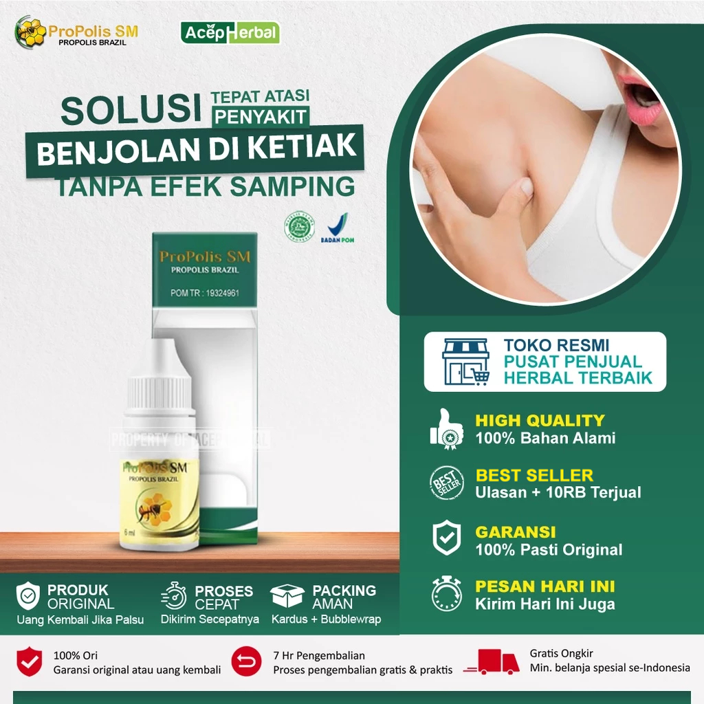 Jual Obat Benjolan Di Ketiak, Menghilangkan Benjolan, Lipoma, Tyroid ...