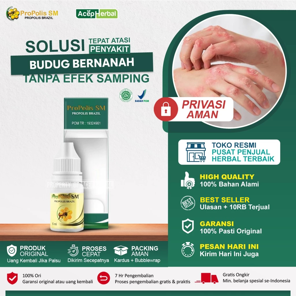 Jual Obat Budug, Infeksi Kulit, Eksim, Kurap, Herpes, Gatal ...