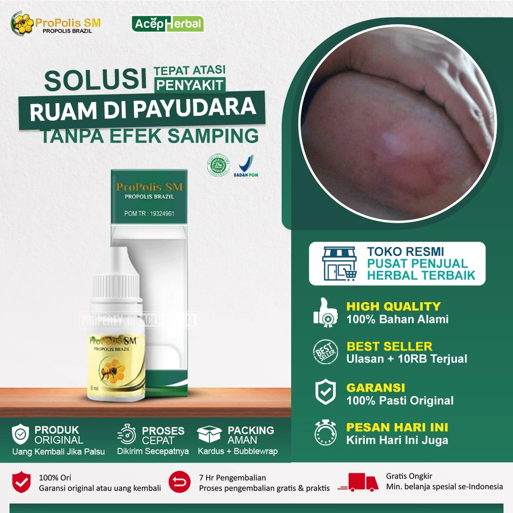 Jual Obat Ruam Pada Payudara Bintik Merah Jamur Puting Lecet Scabies ...