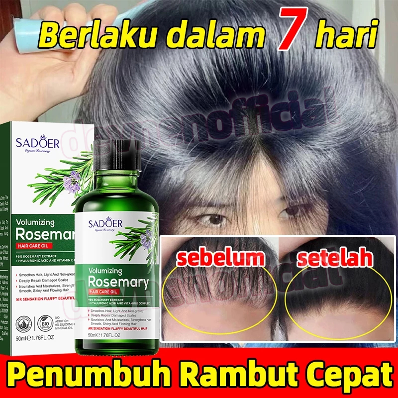 Jual Rosemary Oil minyak rambut Penumbuh Rambut Cepat 50ml pertumbuhan ...