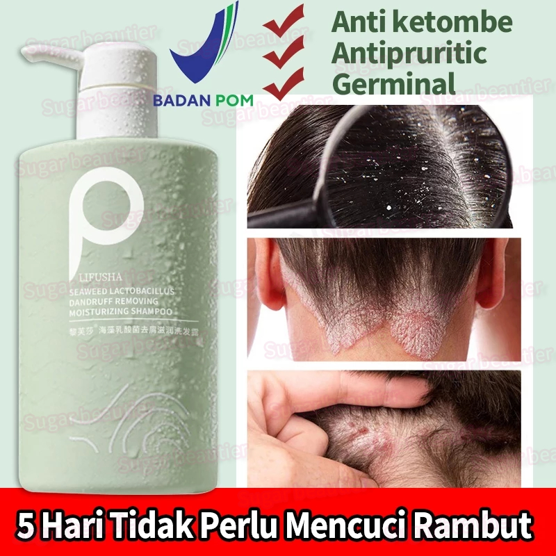 Jual Shampo Anti Ketombe Penghilang Ketombe Anti Gatal Shampoo Sea Salt Shampoo Anti Rambut ...