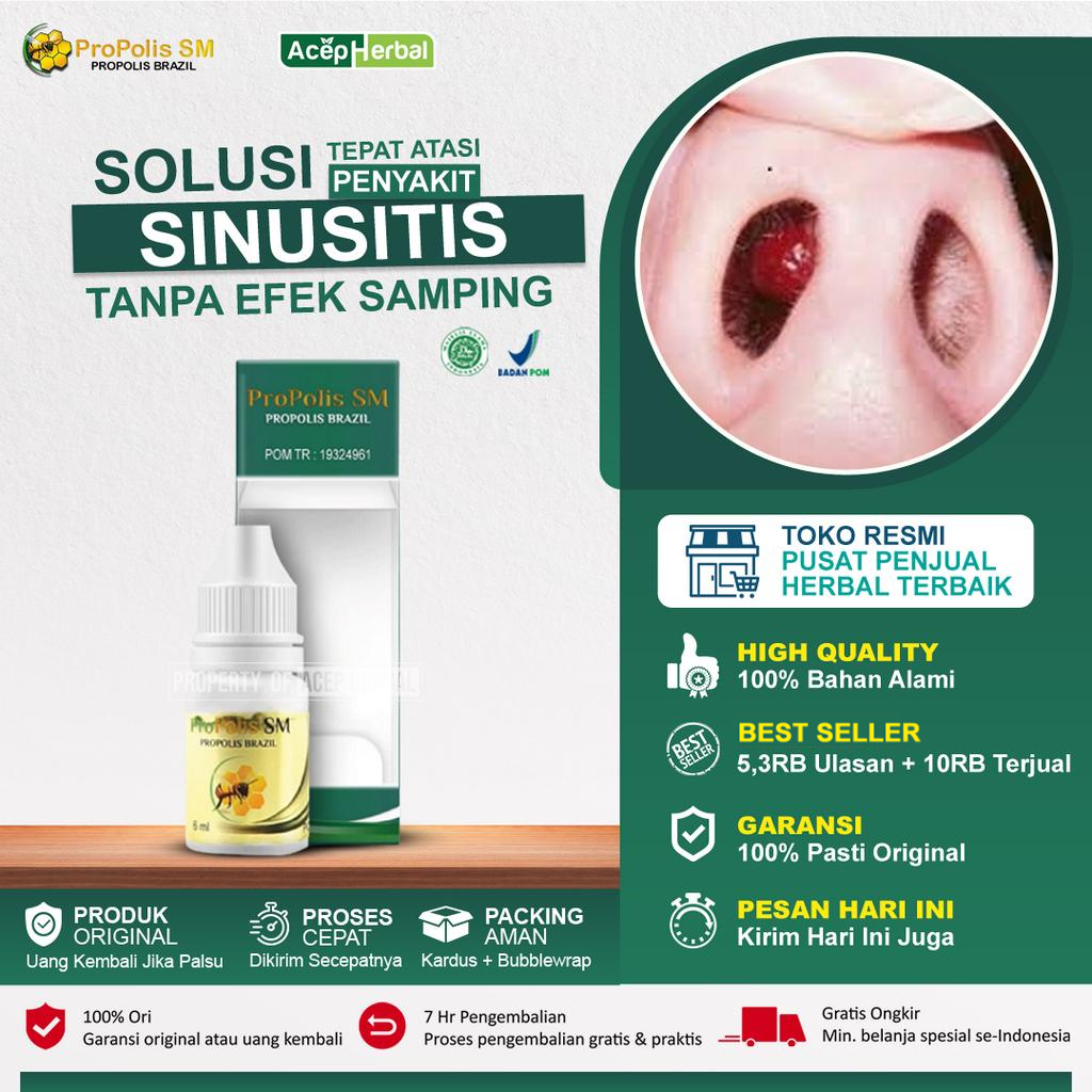 Jual Obat Polip Hidung Sinusitis Menahun Hidung Tersumbat Pilek Anosmia ...