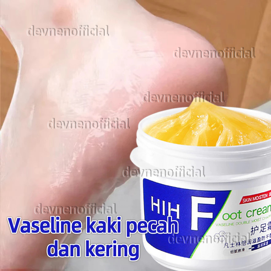 Jual kaki pecah dan kering Foot cream Obat kaki pecah Pelembab kaki ...