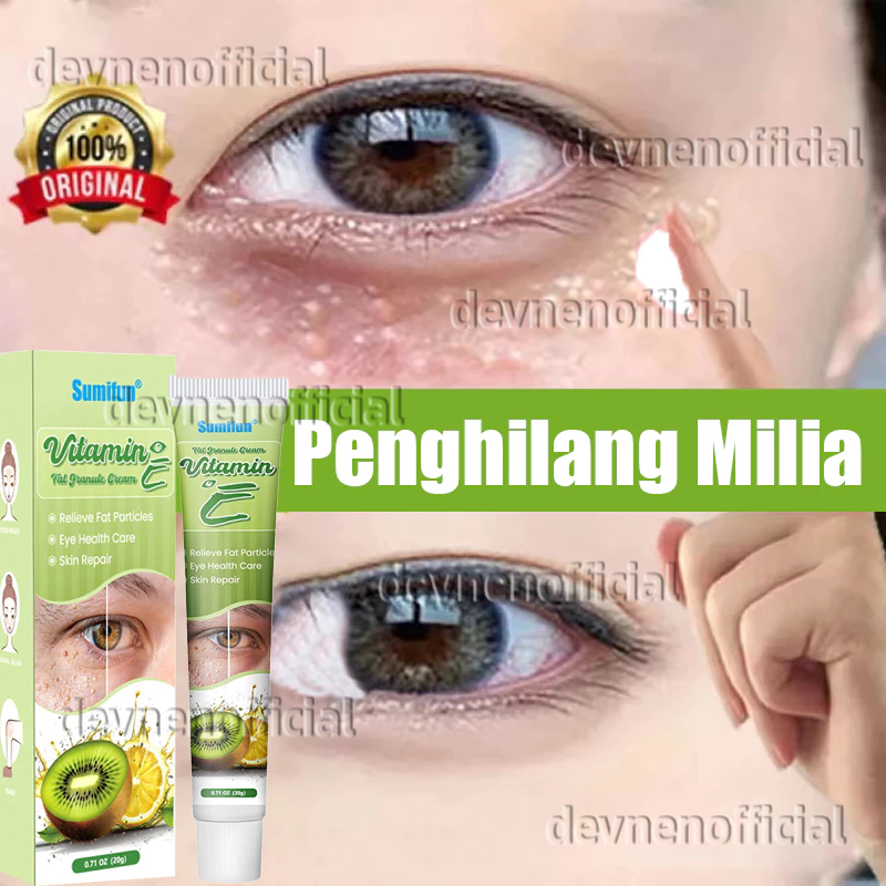 Jual Krim Penghilang Milia Syringoma Xanthelasma Butiran Lemak Sekitar Mata Milia Remover Cream