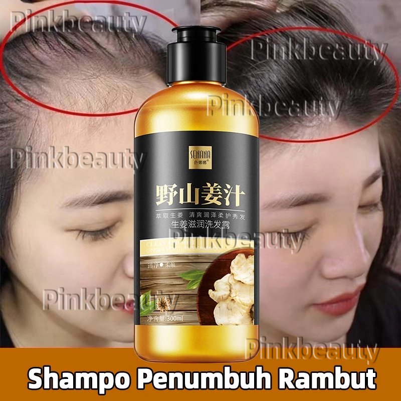 Jual Shampo Penumbuh Rambut Cepat 300ml Ginger Shampoo pertumbuhan rambut Pengendalian Minyak ...