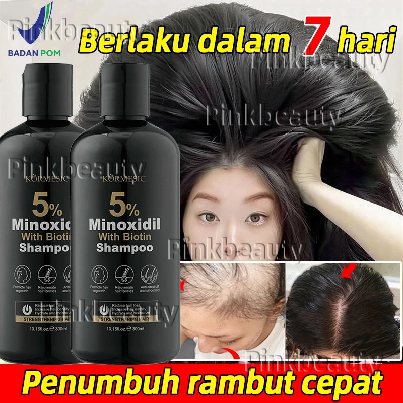 Jual Shampo Minoxidil 5% 300ml Shampo Penumbuh Rambut Cepat pertumbuhan rambut Pengendalian ...