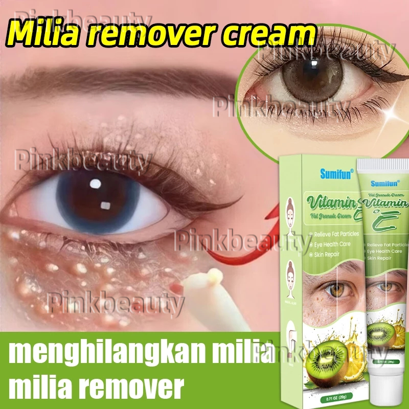 Jual krim penghilang milia syringoma xanthelasma butiran lemak sekitar ...