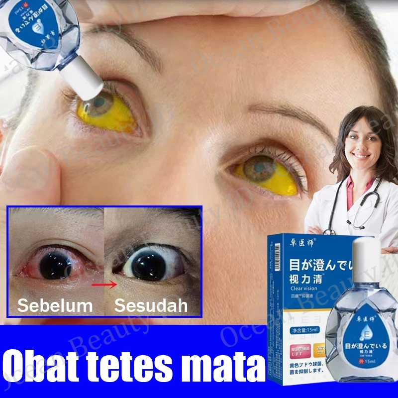 Jual Tetes Mata Obat Mata Katarak 15ml Obat Mata Merah Obat Sakit Mata ...