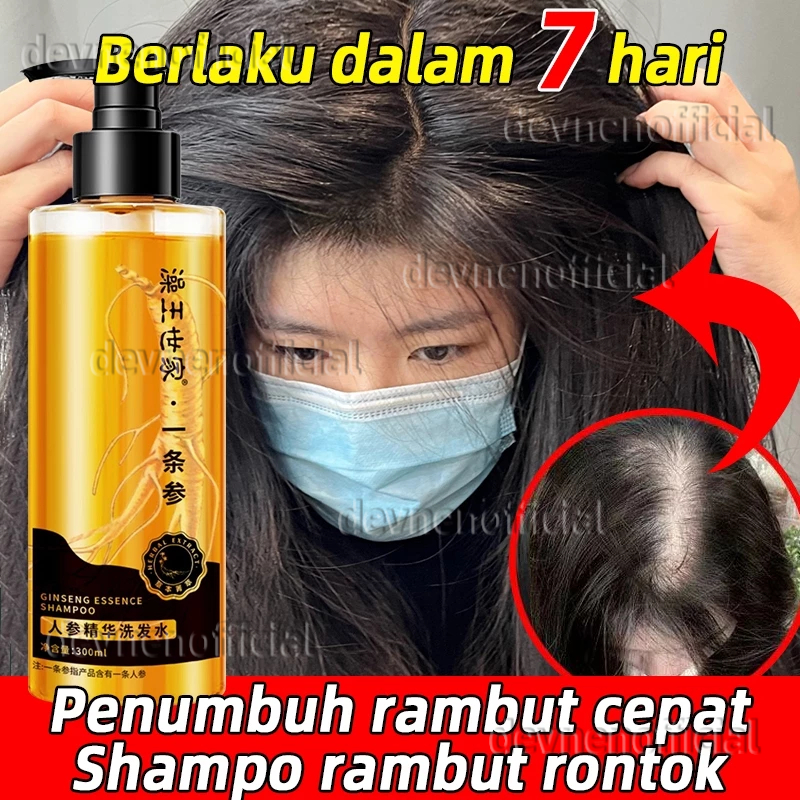 Jual Ginseng Shampoo 300ml Shampo Penumbuh Rambut Cepat pertumbuhan rambut Pengendalian Minyak ...
