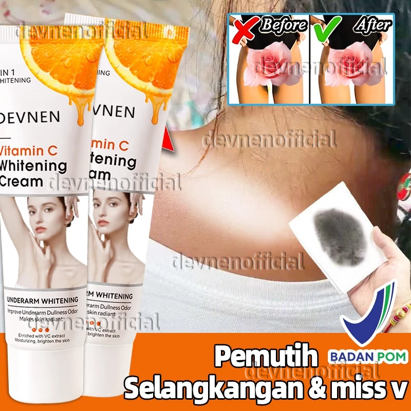 Jual Krim Pemutih Ketiak 50g Miss V Pemutih Selangkangan Vitamin C Underarm Whitening Cream ...