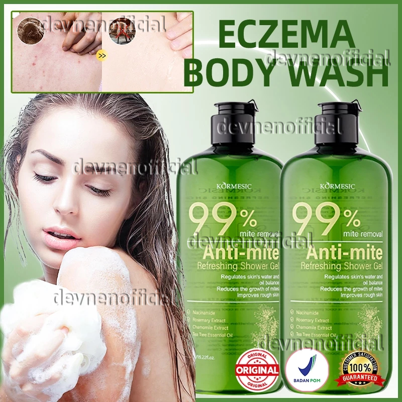 Jual 450ml eczema Body Wash Sabun Gatal Cair Untuk Pengobatan Eksim psoriasis eksim kering Kurap ...