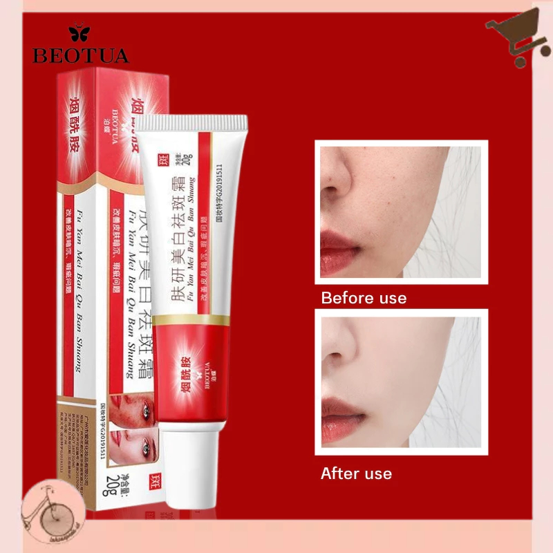 Jual BEOTUA Anti-Blemish Cream Whitening Brightening Menghilangkan ...