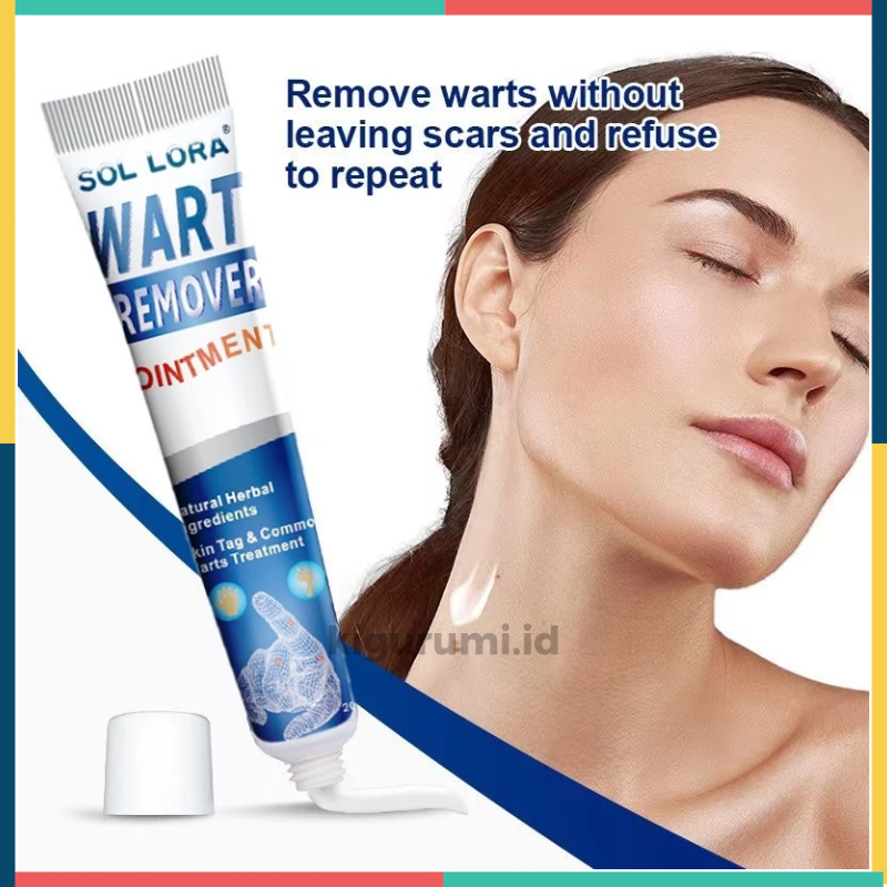 Jual SOL LORA Wart Remover Original Krim Penghilang Tahi Lalat di Wajah Permanen 20g XX032 ...