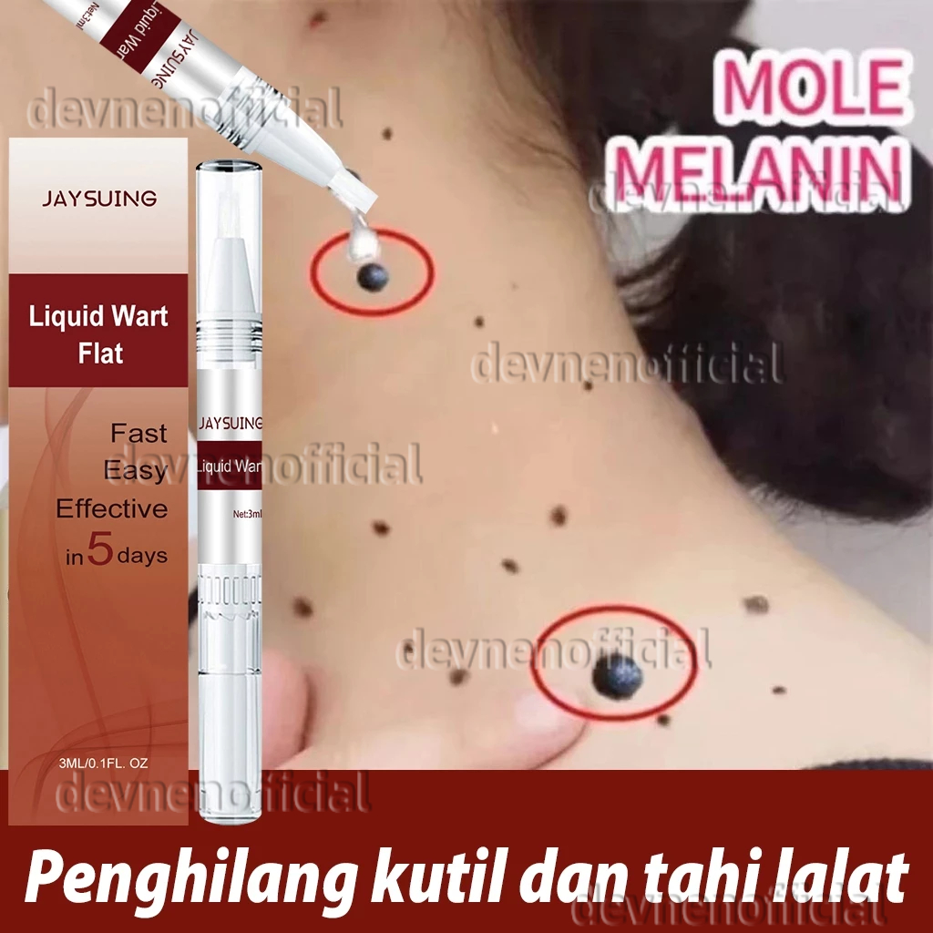 Jual Obat Penghilang kutil dan tahi lalat Ampuh Wart Removal Pen ...