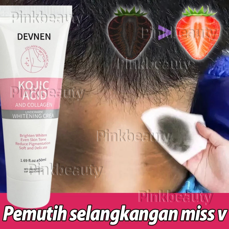 Jual Pemutih selangkangan dan miss v 50g Krim Pemutih Ketiak Kojic Acid ...