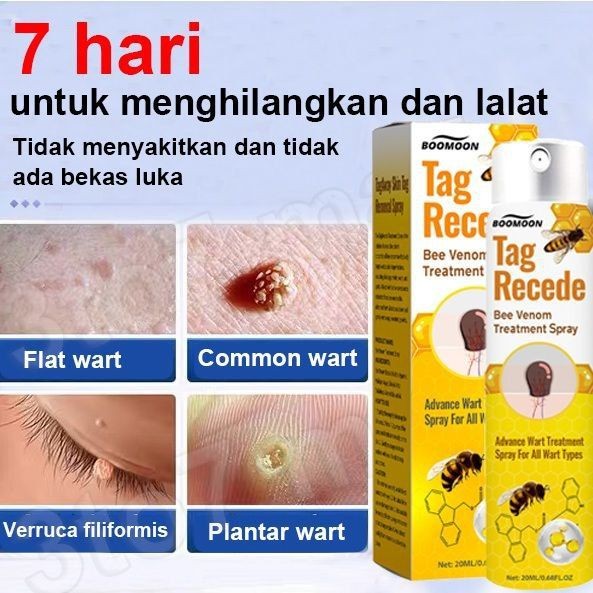 Jual Penghilang tahi lalat di wajah Penghilang kutil di leher Wart ...
