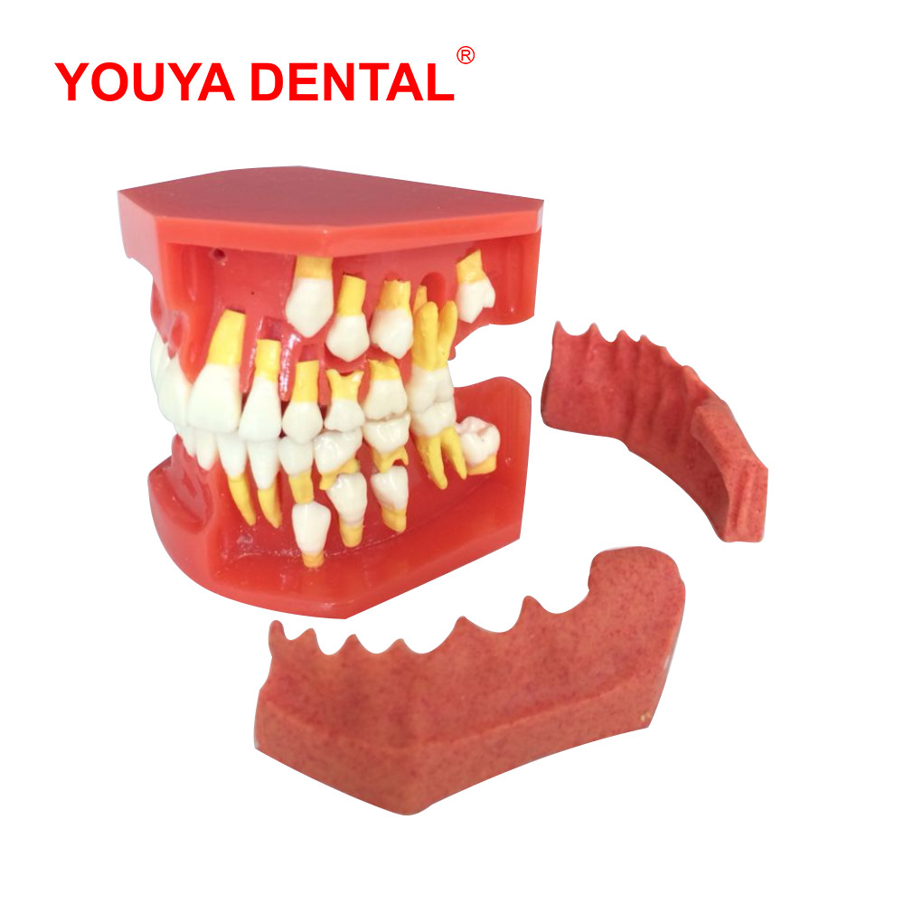 Jual New Dental Model Resin Children Primary Permanent Tooth Model ...