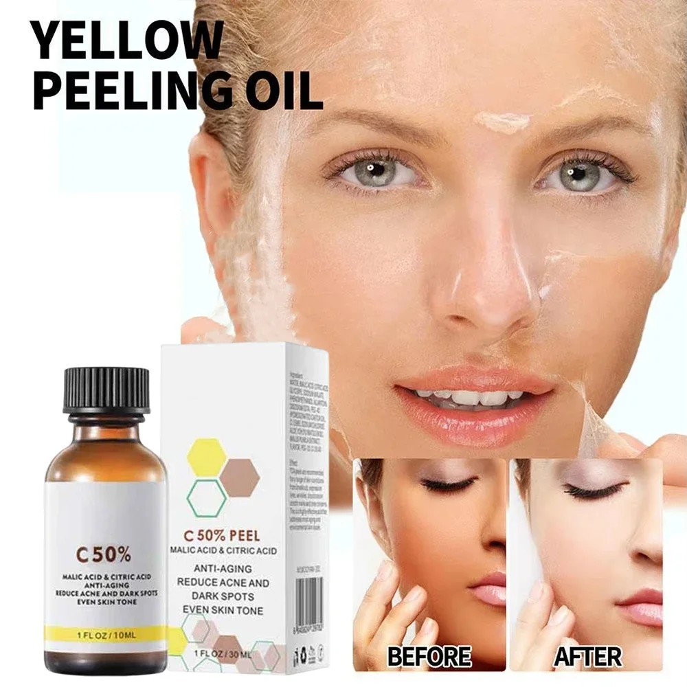 Jual IMPORT High Quality 50% Chemical Peel Peel Acid Skin Superforce ...