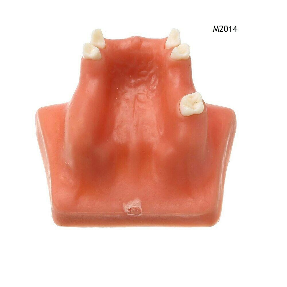 Jual Dental Study Teaching Model Maxillary Lift Model Upper Sinus ...