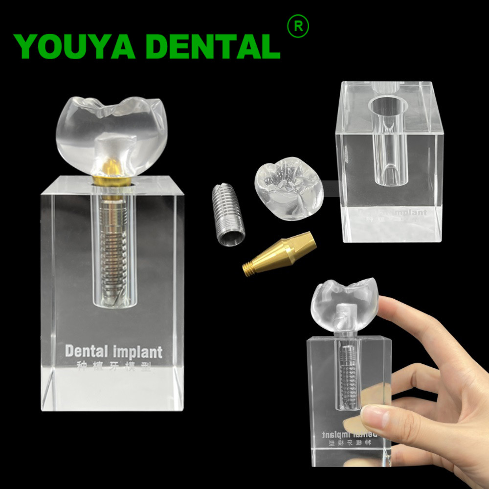 Jual Dental Implant Model Single Tooth Crystal Implant Demonstration ...
