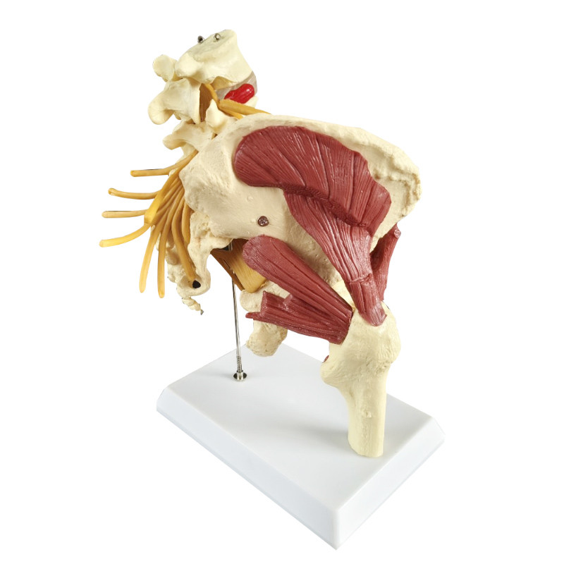 Jual 1:1 Nerves Hip Joint Muscle Anatomy Model Removable Movable Femur ...